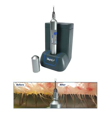 Why Are My Eyes Chronically Dry and Itchy? | Dr. Gregory Pamel