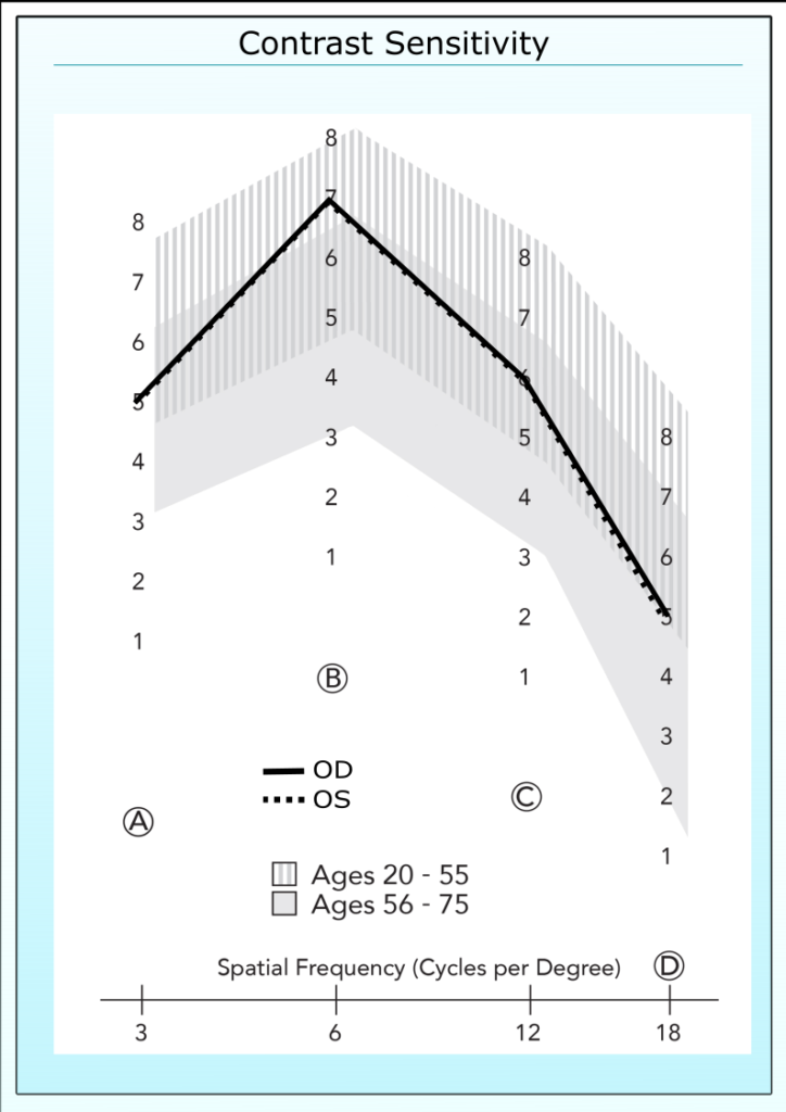 Contrast Sensitivity Testing – How Is it Different Than Visual Acuity?